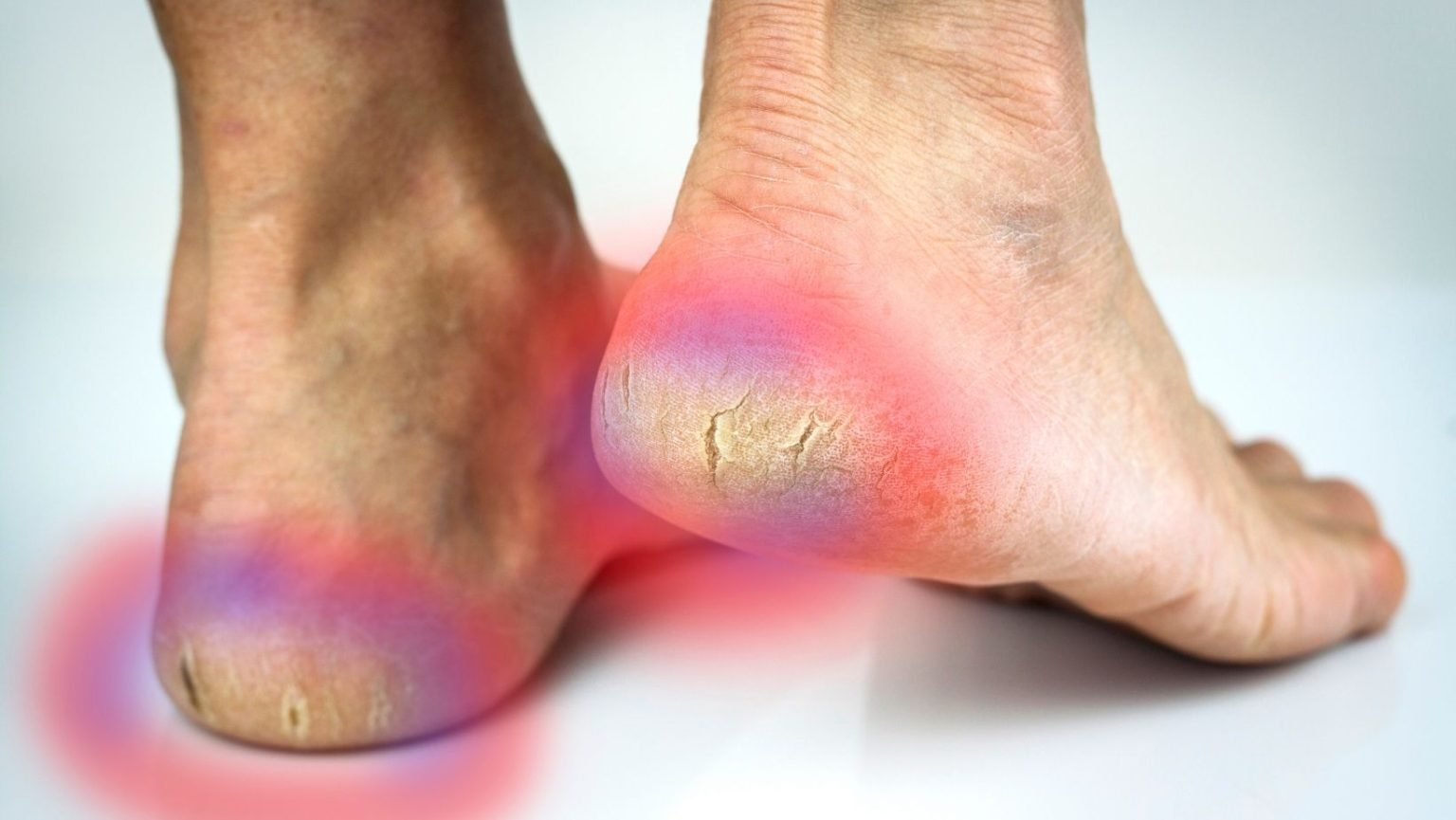 Causes of Cracked Heels Treatment - Sparsh Skin Clinic
