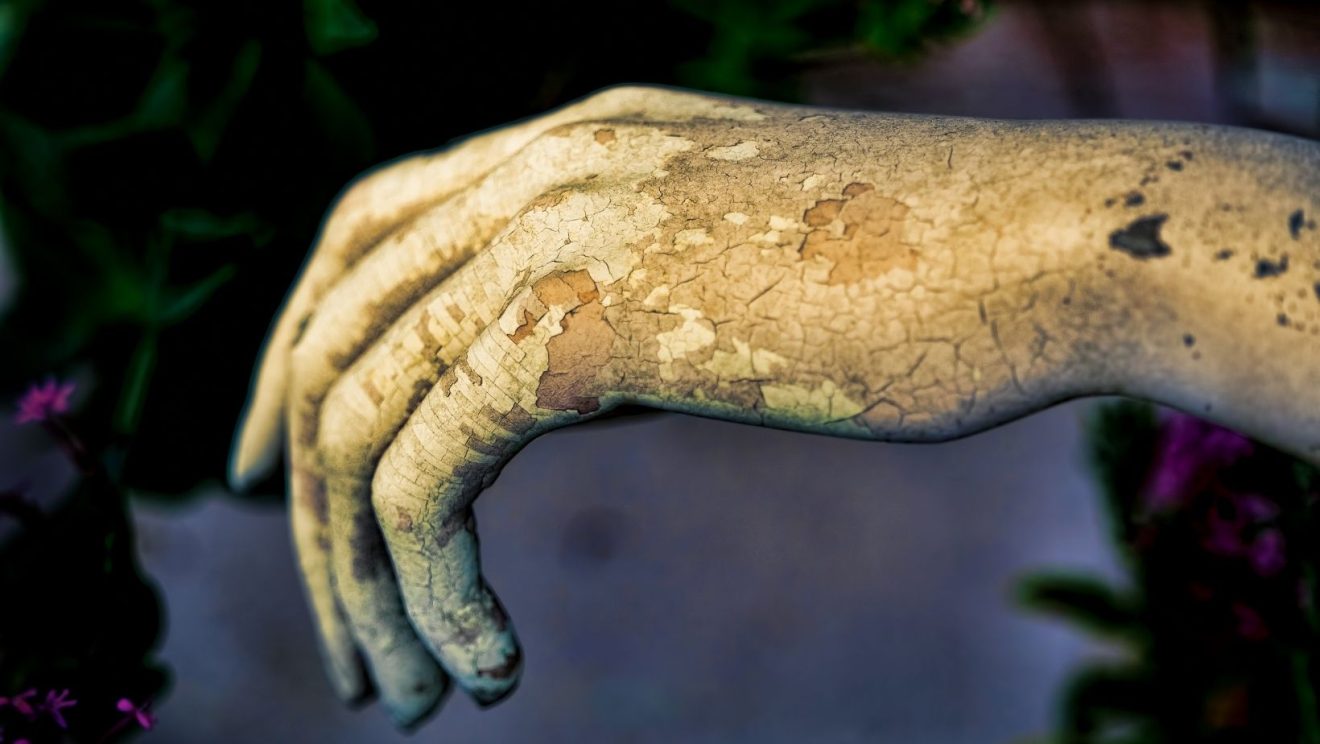 Steroid Induced Atrophy Treatment - Sparsh Skin Clinic