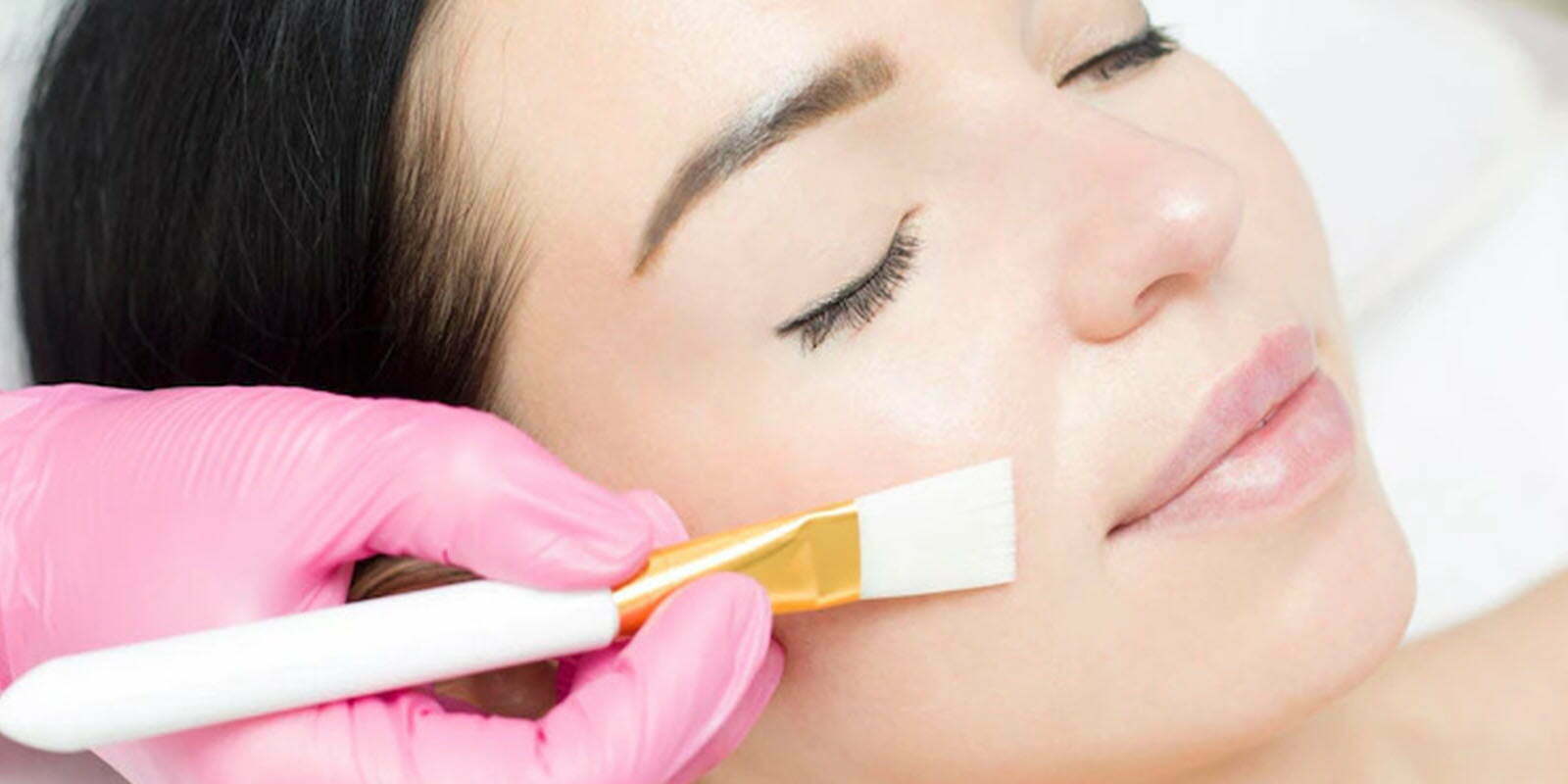 Chemical peels Treatment - Sparsh Skin Clinic