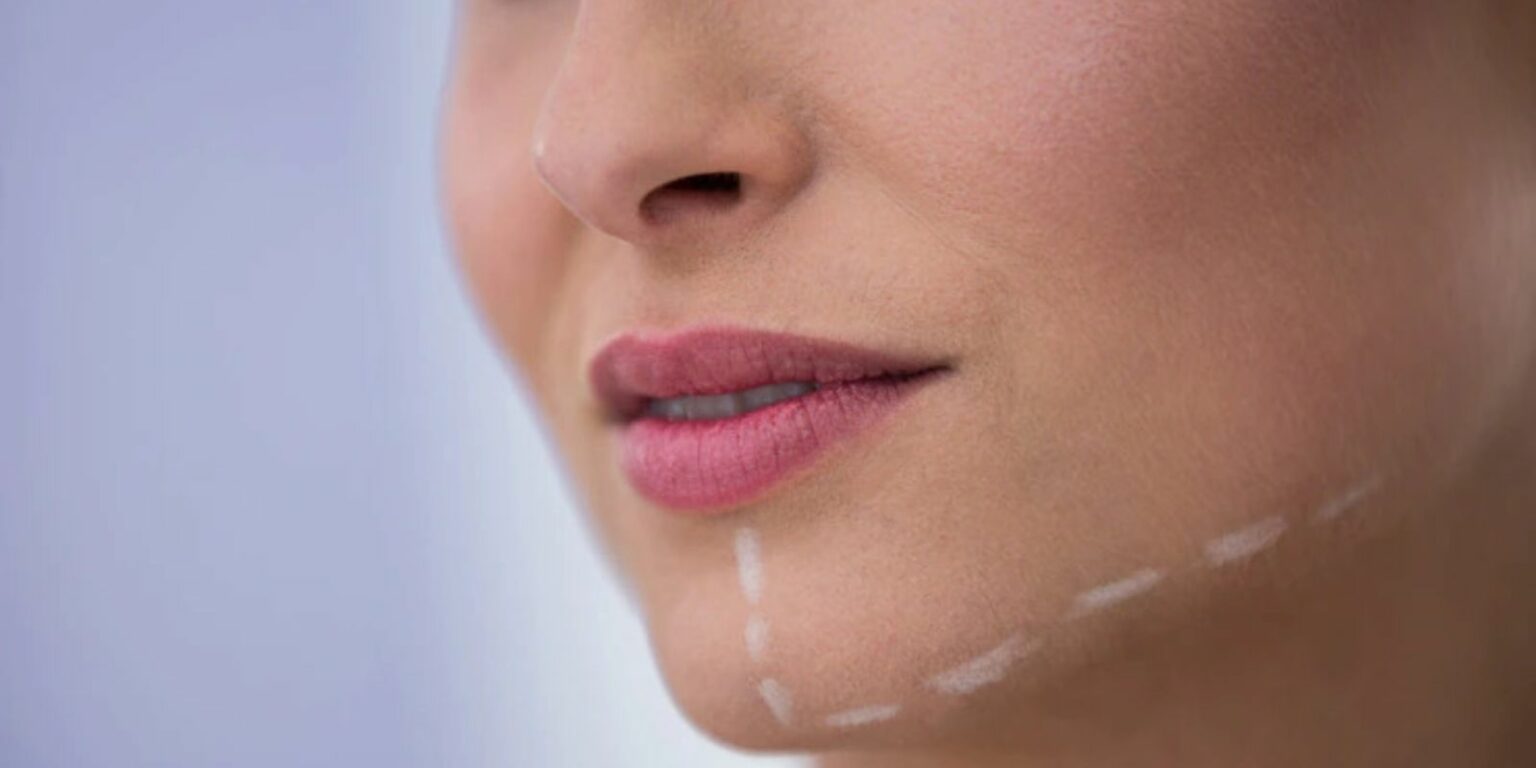 Jaw Contour & Jawline Shape Treatment - Sparsh Skin Clinic