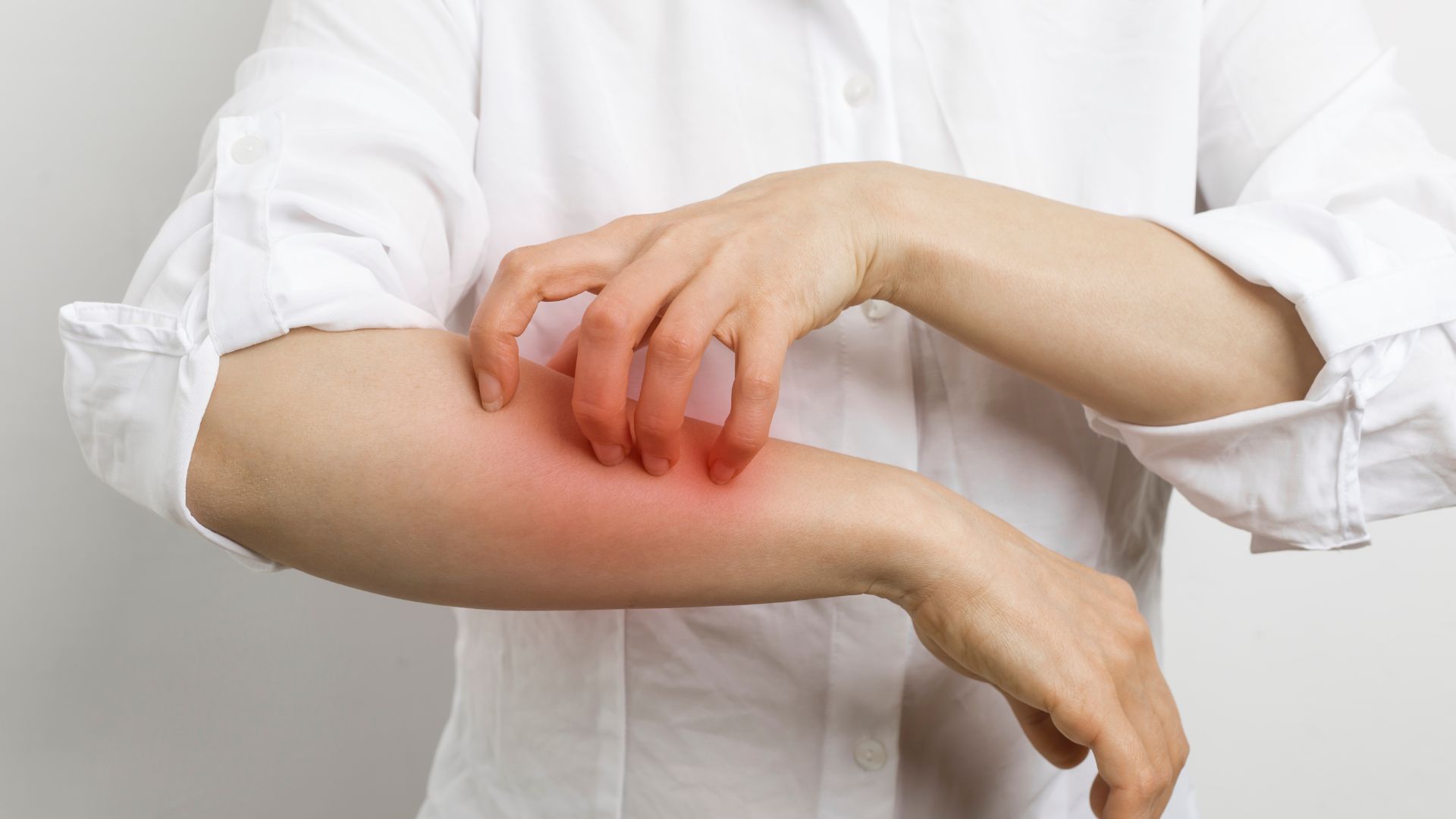 Skin Allergies: Beyond the Pill - Can We Find a Cure? (True or False ...