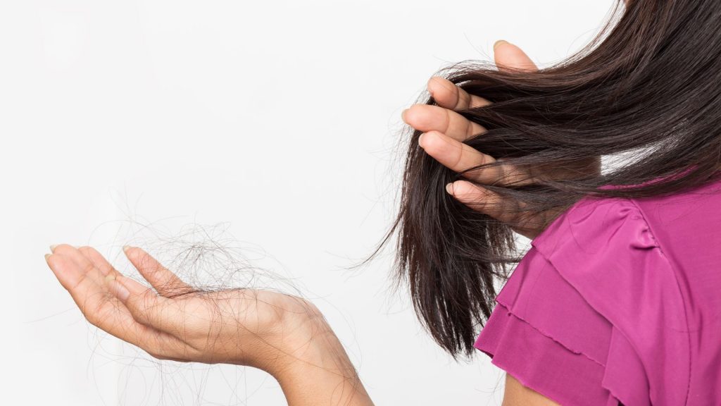 Understanding Female Pattern Hair Loss (Androgenetic Alopecia ...