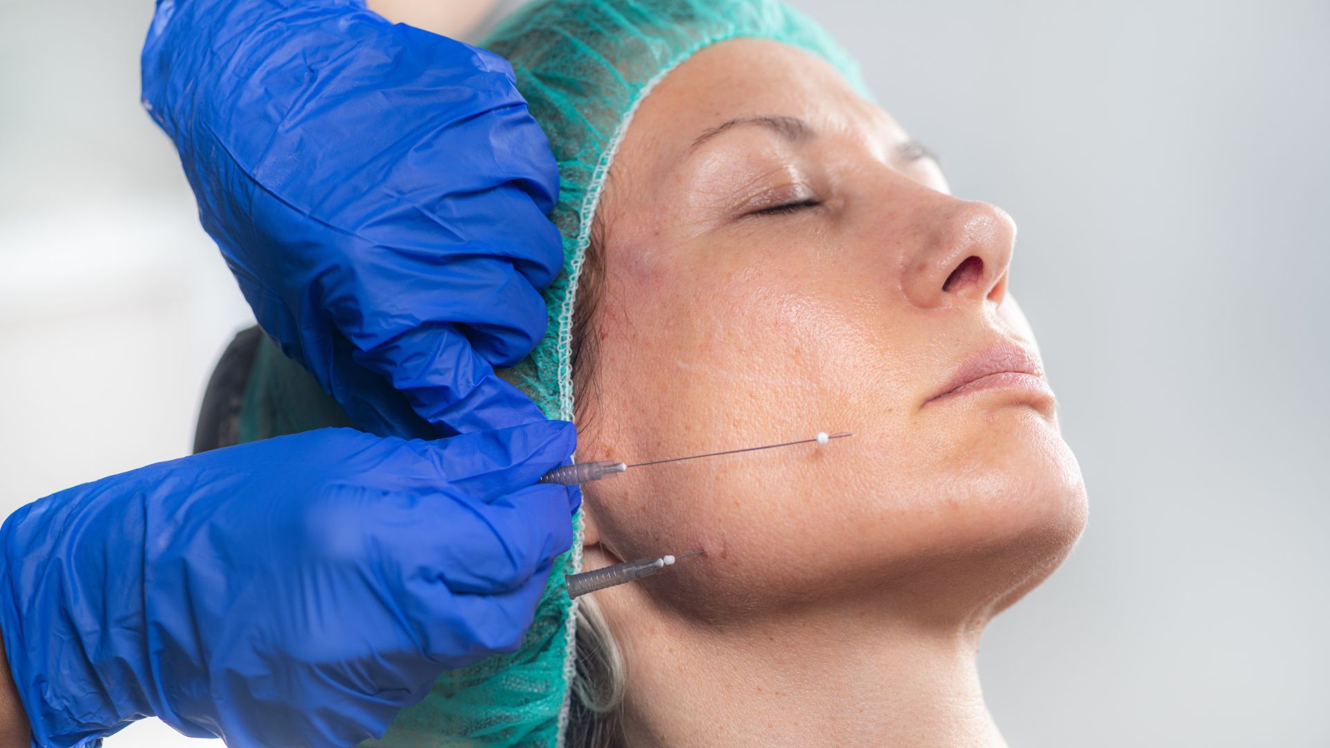 Thread Lift Post-Care: Ensuring Optimal Results and Comfort - Sparsh ...